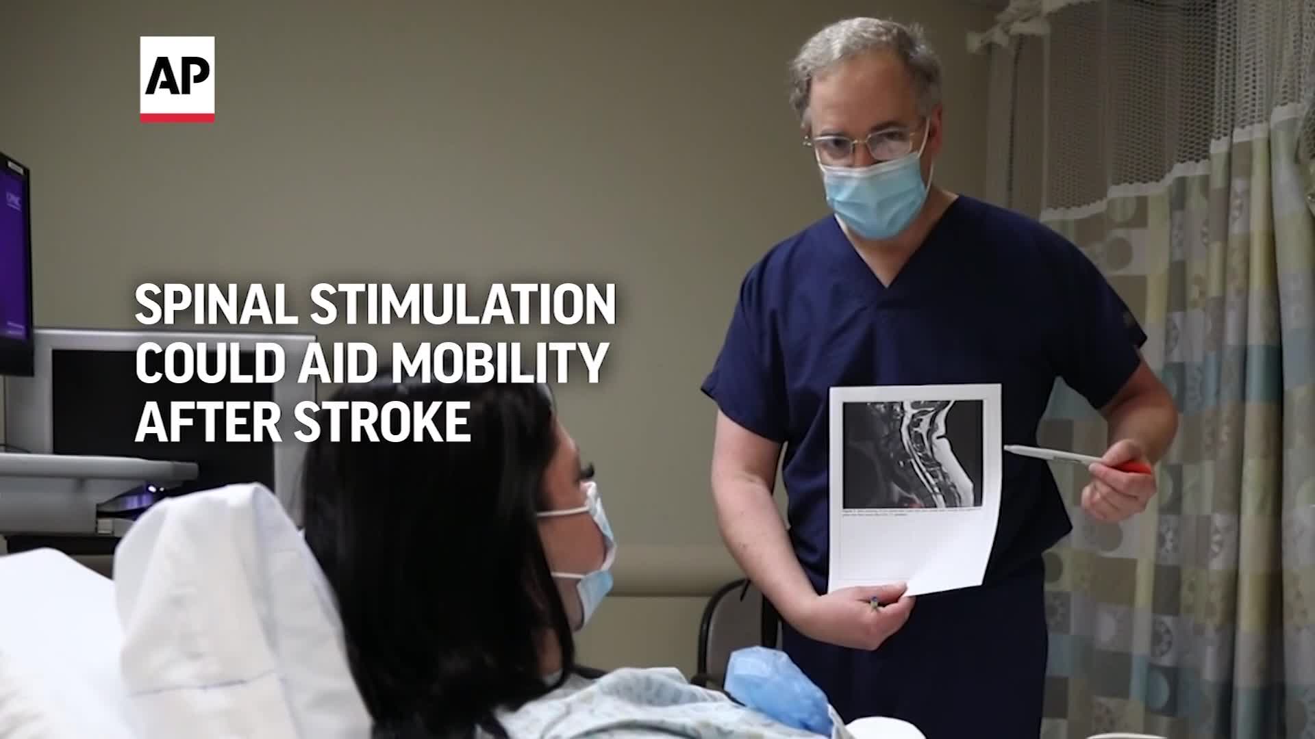 Medical ‘zaps’ to spine help stroke survivors move their arms – WSPA 7NEWS